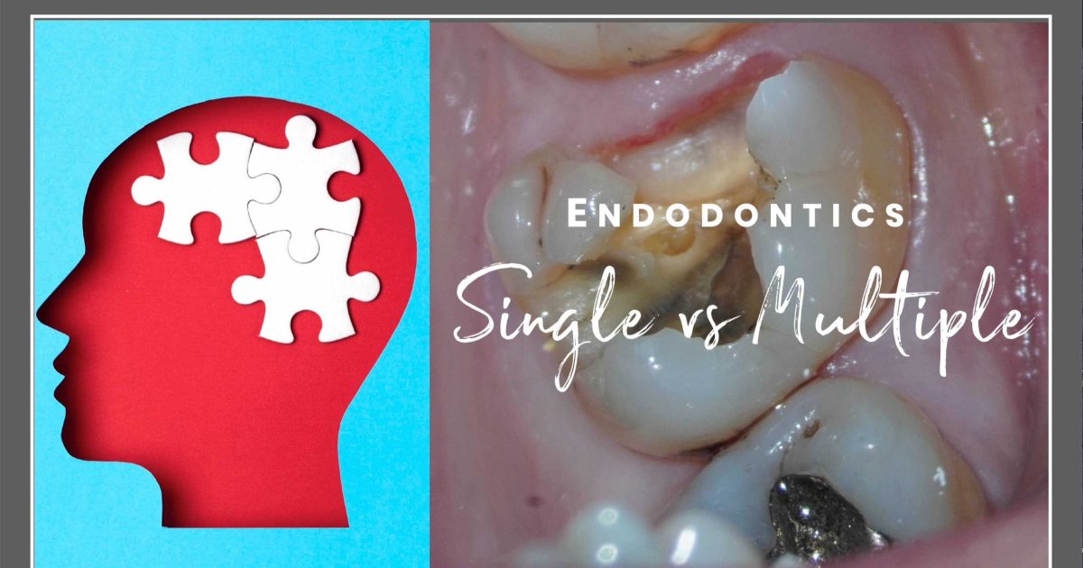 Single vs multiple visit treatments | Contemporary Endodontics