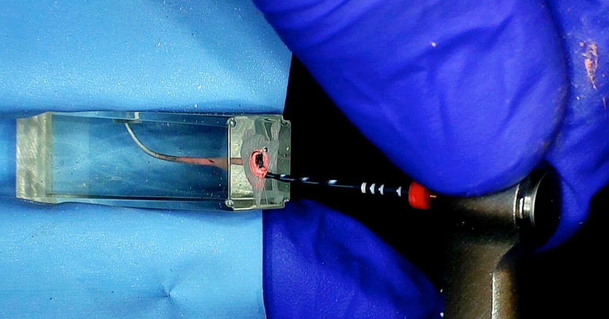 Thermafil removal - Hands on with Reciproc Blue | Contemporary Endodontics