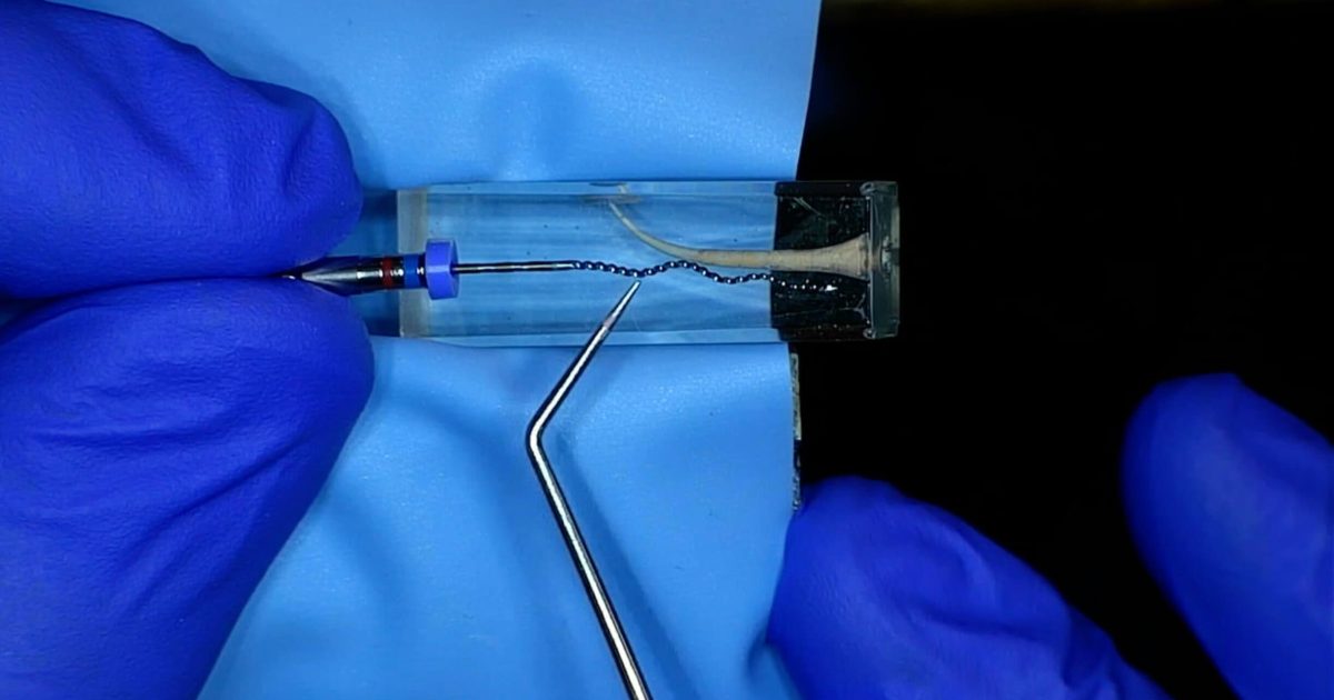 Gutta-percha removal hands on | Contemporary Endodontics